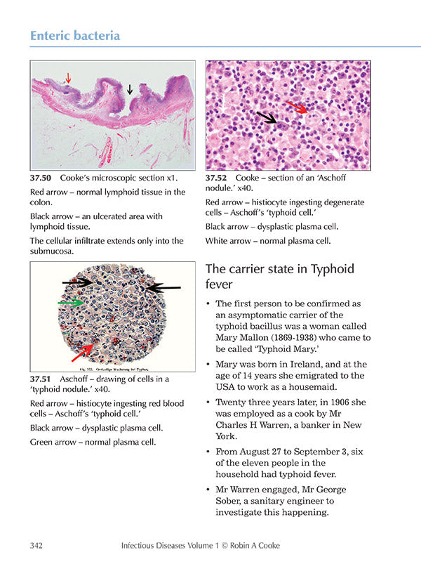 Infectious Diseases Volumes 1 and 2 eBook Bundle CD204 9781922516701 ...